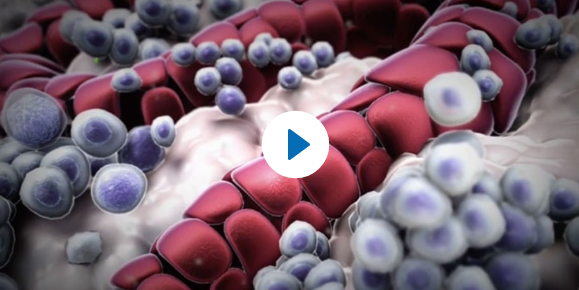 Dosing & Application | Neulasta® (pegfilgrastim) Onpro®